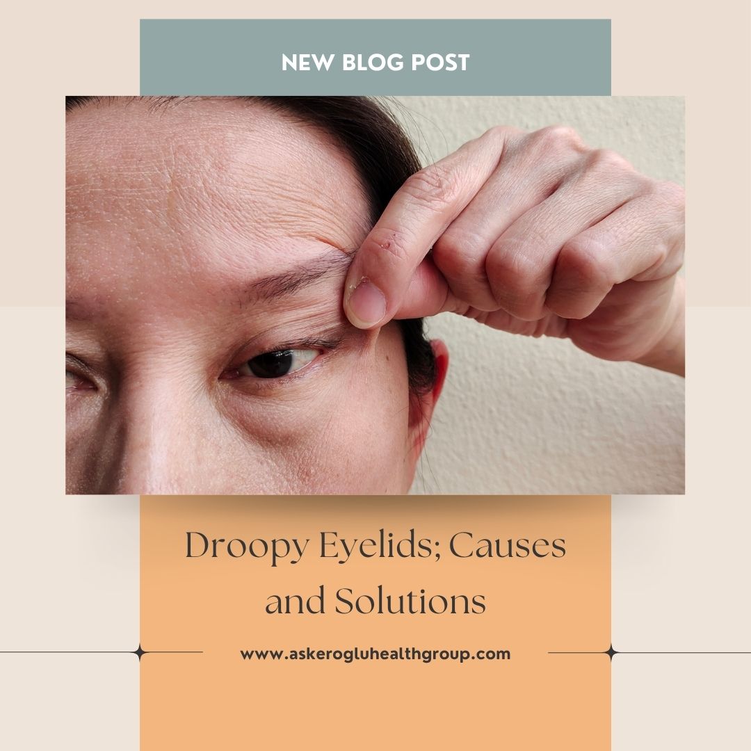 Droopy Eyelid Causes Solutions - Askeroglu Health Group
